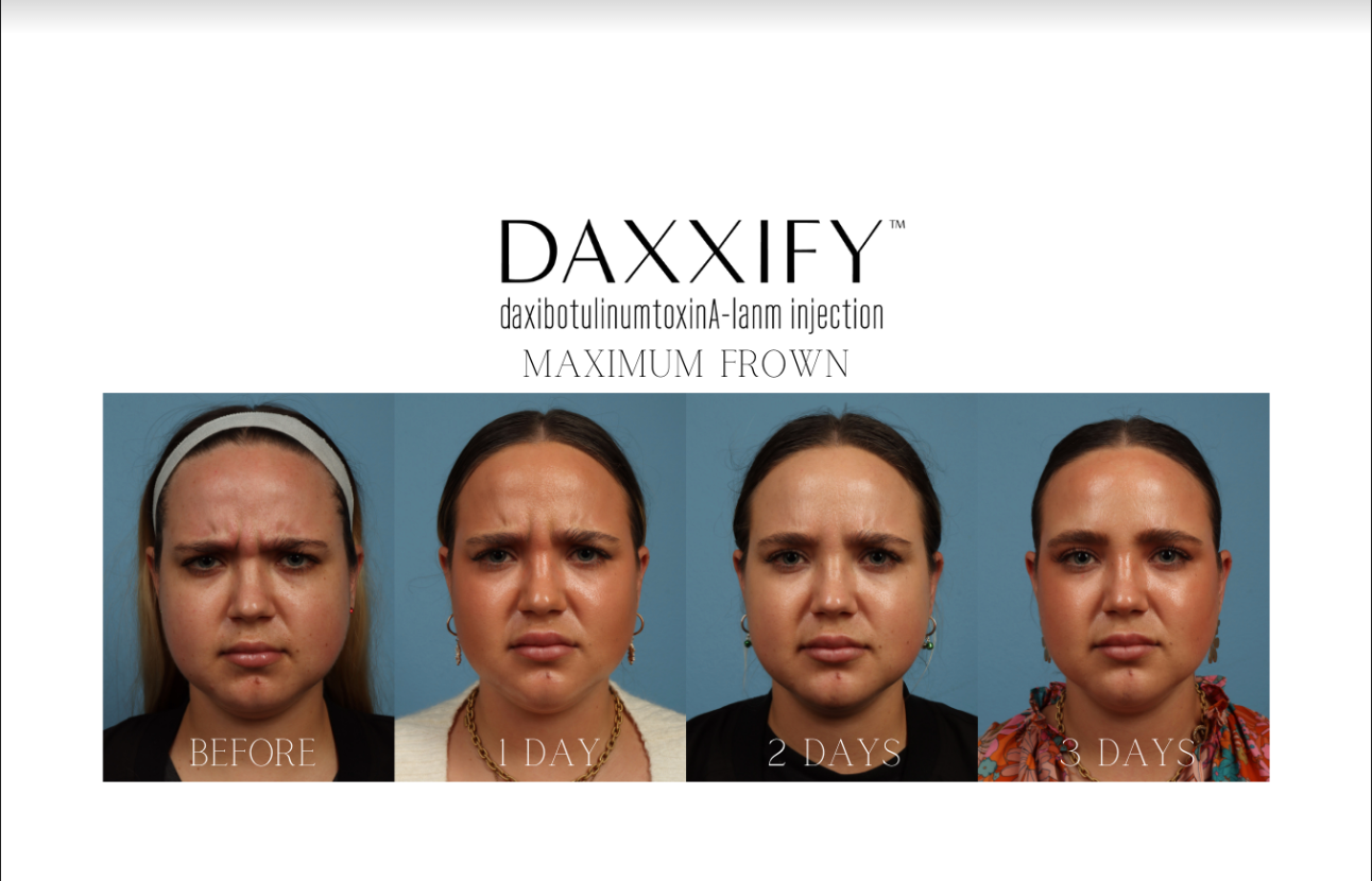DAXXIFY™ | Fresno, CA | Behr Laser & Skin Care Center